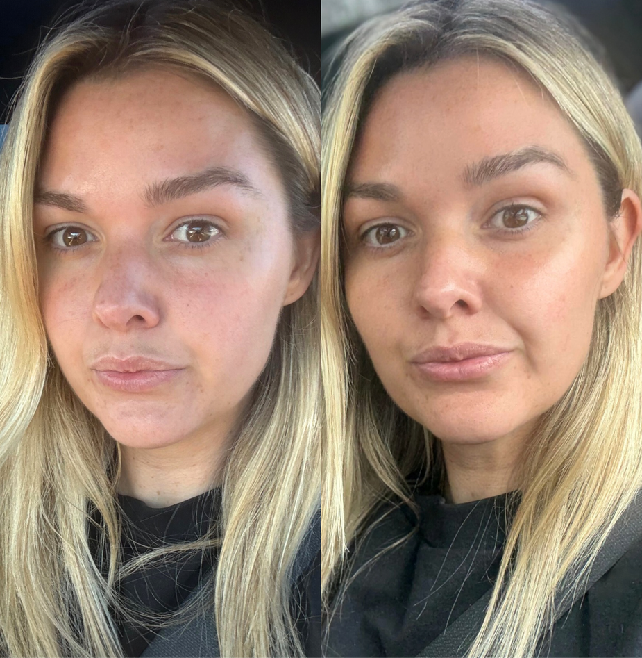 Buildable Self-Tanning Glow Drops | 5 Star Rated Face Tan – Summer Skin ...